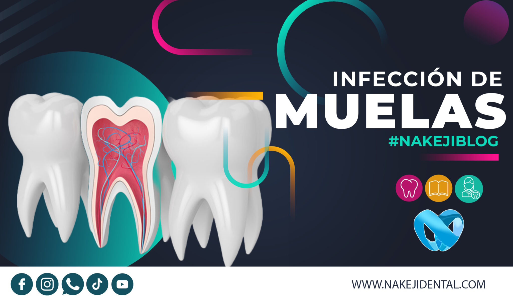 BLOG Infección de muelas - Clínica Dental Nakeji