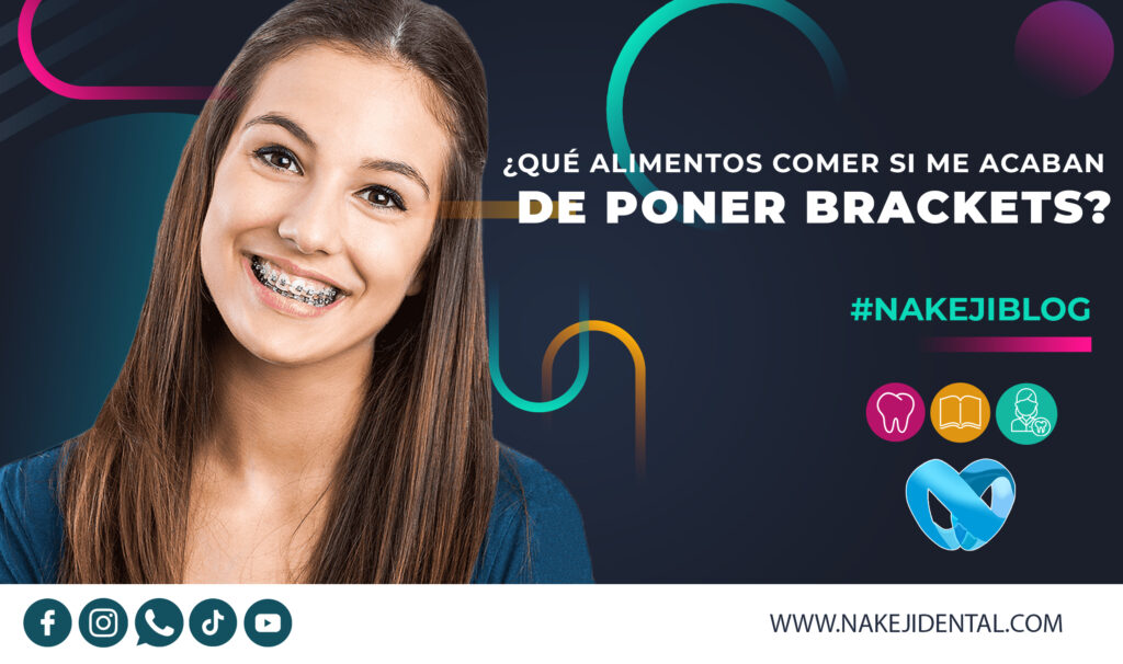 BLOG ¿QUÉ COMER SI ME PONEN BRACKETS? - Clínica Dental Nakeji